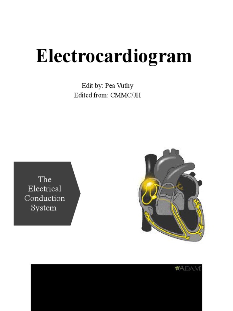 Electrocardiogram: Edit By: Pea Vuthy Edited From: CMMC/JH | PDF ...