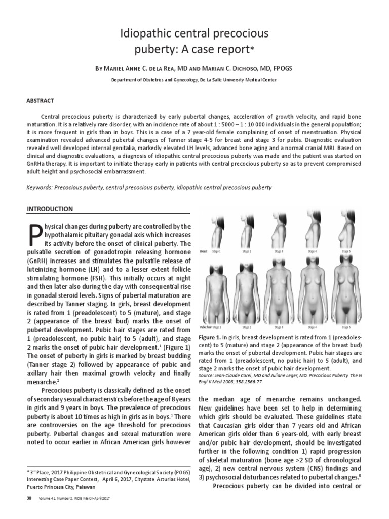 Idiopathic Central Precocious Puberty A Case Report | PDF | Puberty ...