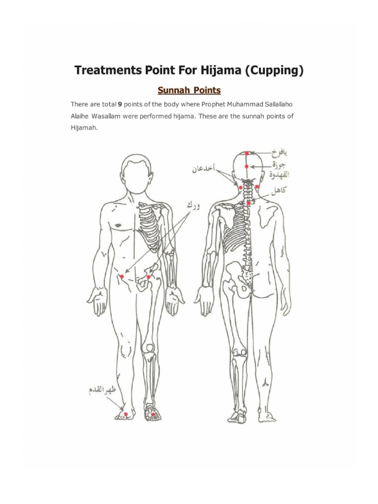 Cupping Treatment Points Pages 1-18 - Flip PDF Download - FlipHTML5 | PDF
