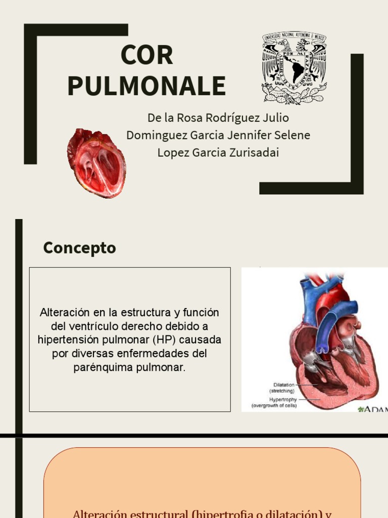 Cor Pulmonale | PDF | Corazón | Electrocardiografia