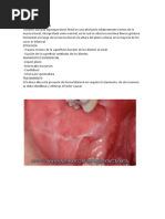 Canino Temporal Superior | PDF | Anatomia dental | Diente