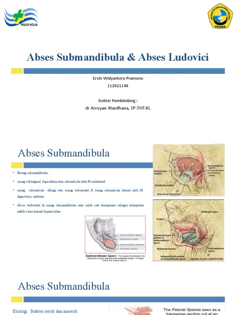 Abses Submandibula - Angina Ludwig | PDF