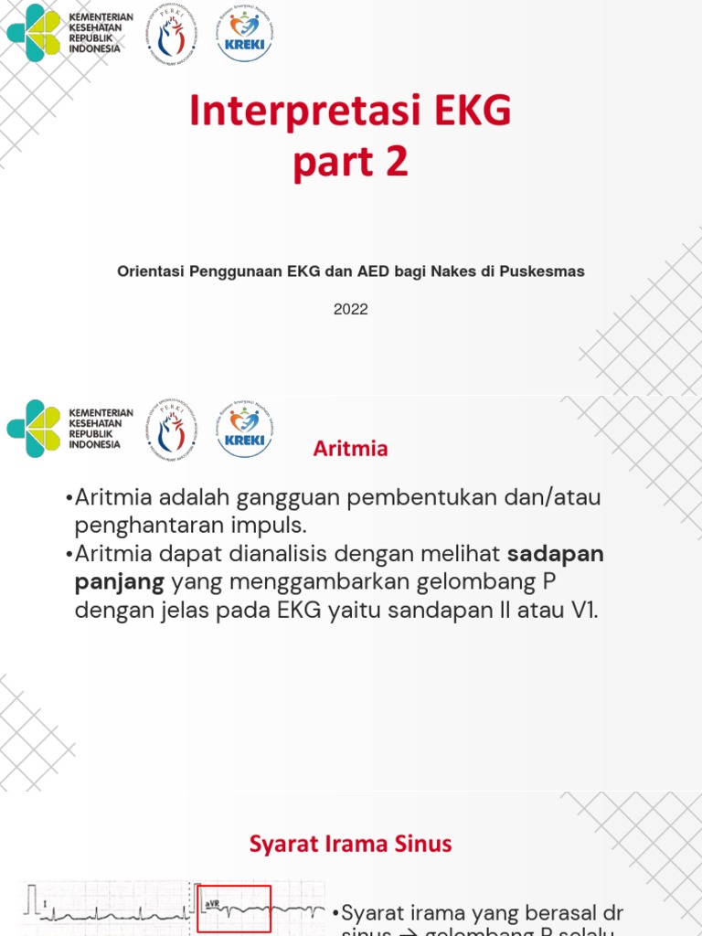 Interpretasi EKG 2 (Aritmia Dan SKA) | PDF