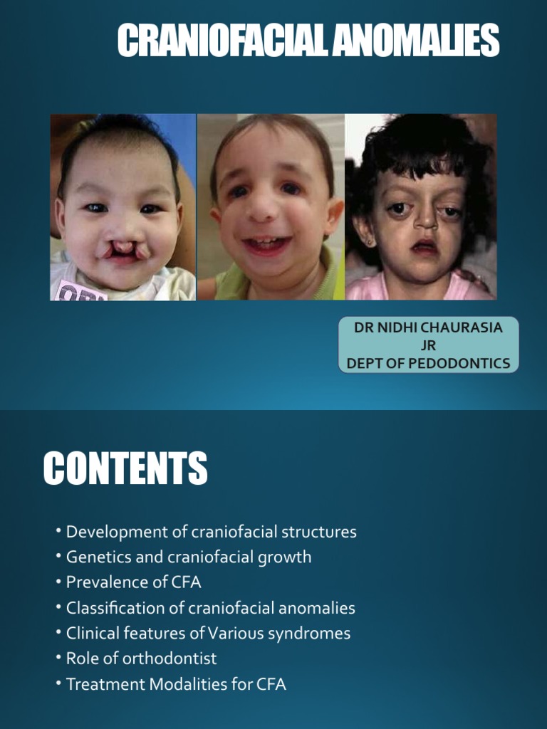 Craniofacial Anomalies: DR Nidhi Chaurasia JR Dept of Pedodontics | PDF ...