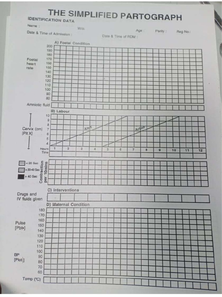 New Partograph | PDF