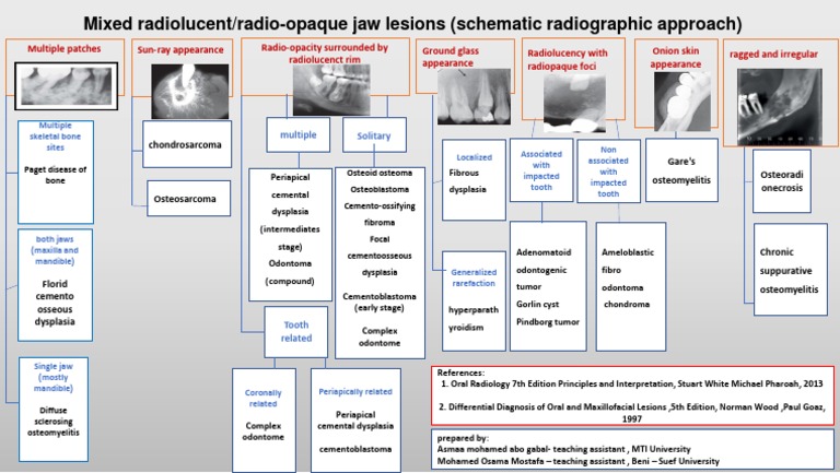 Mixed Radiolucent/radio-Opaque Jaw Lesions (Schematic Radiographic ...