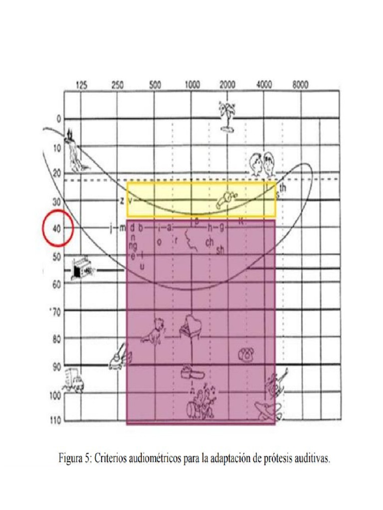 audiograma T01A | PDF