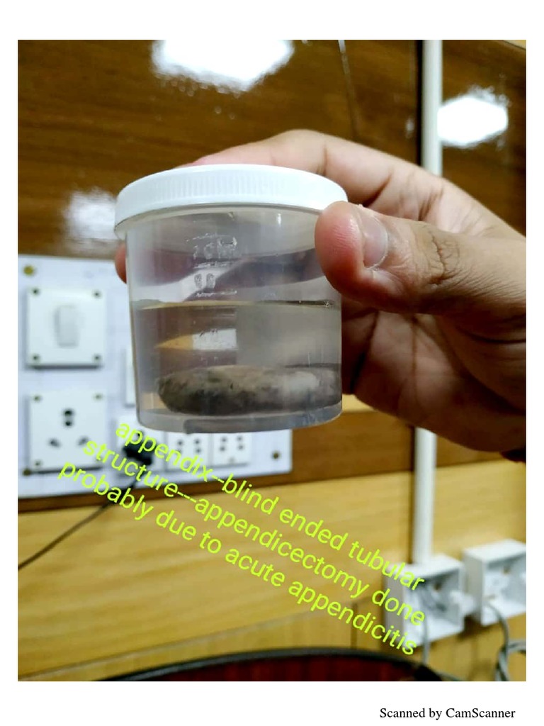 Surgery Specimens | PDF