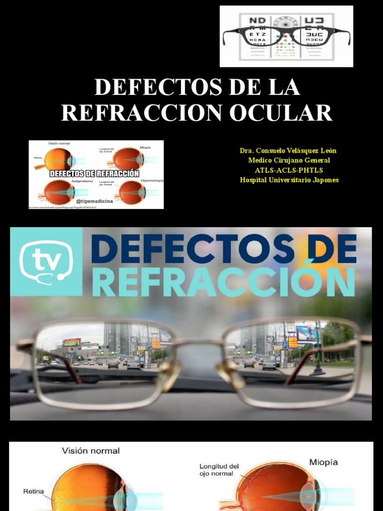 Defectos de La Refraccion Ocular | PDF | Ciencia y matemáticas