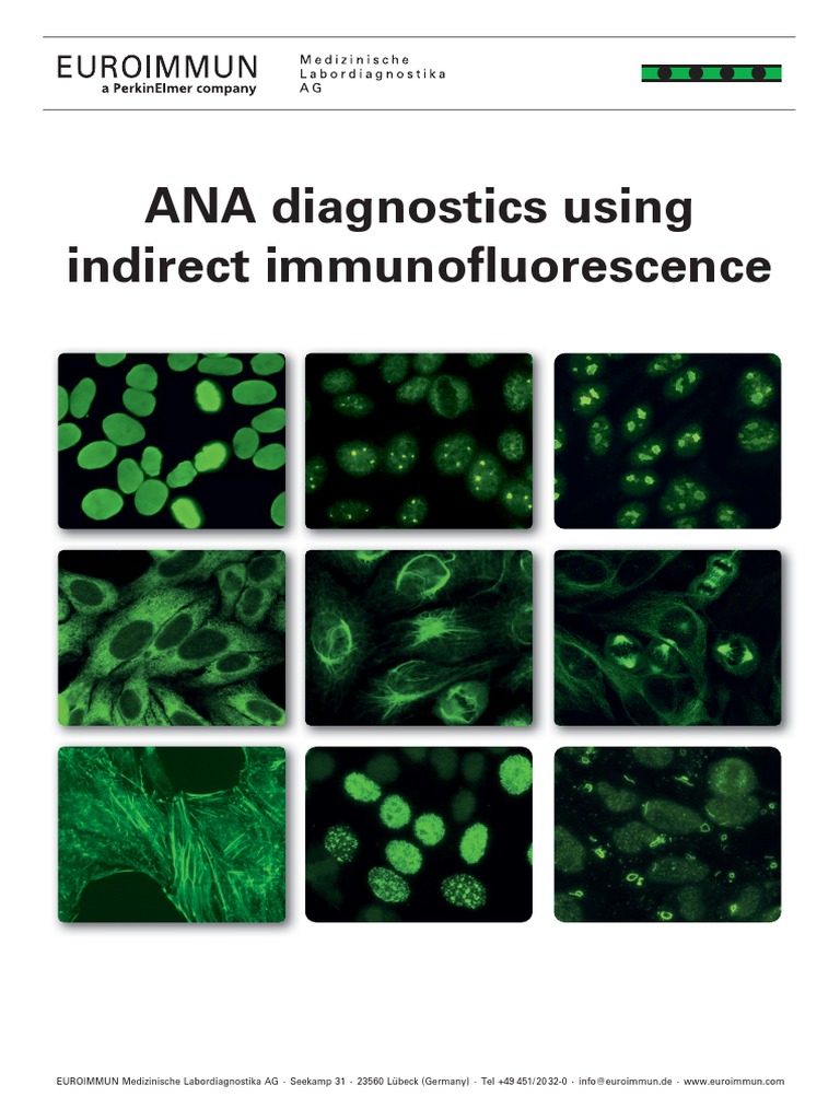 ANA Diagnostics Using Indirect Immunofl Uorescence | PDF | Cell Nucleus ...