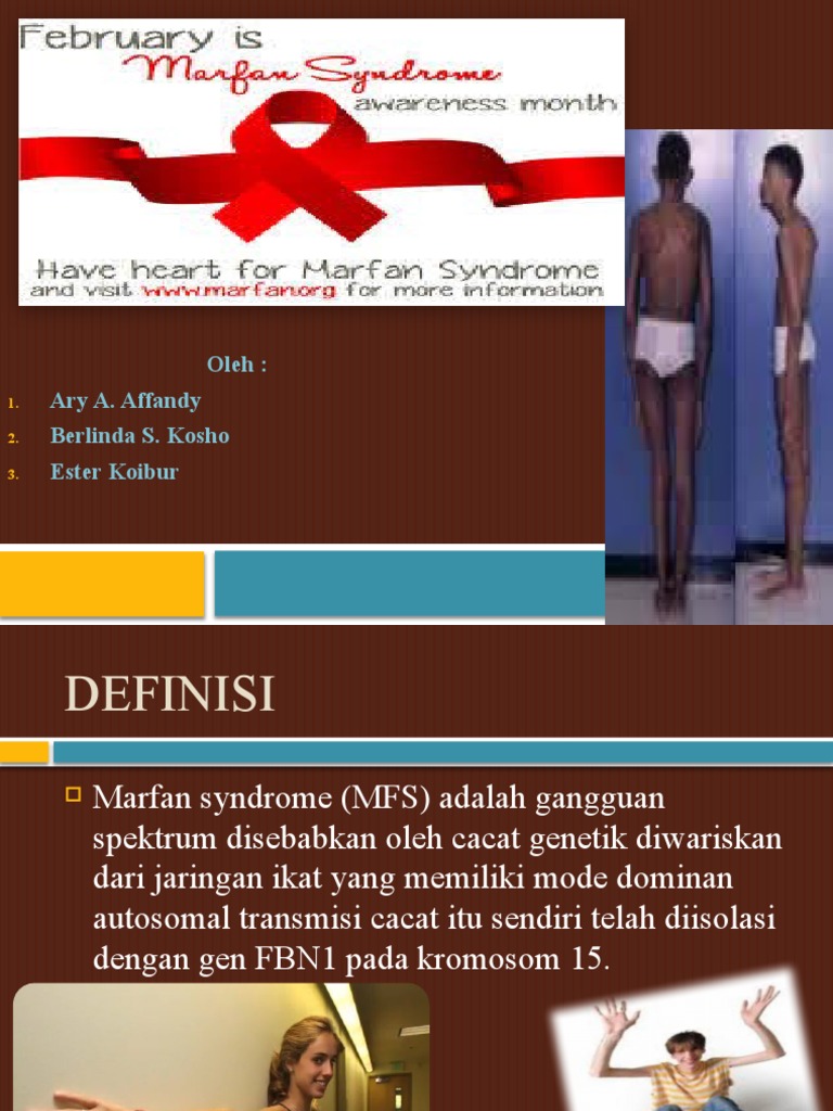 Sindrom-Marfan | PDF