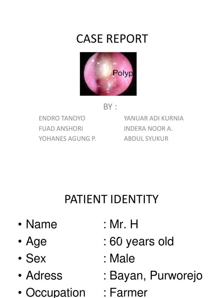 Chronic Rhino Sinusitis With Suspect Ion Nasal Polyps New | Diseases ...