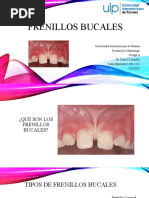 Clasificacion de Frenillos | PDF | Lengua | Boca