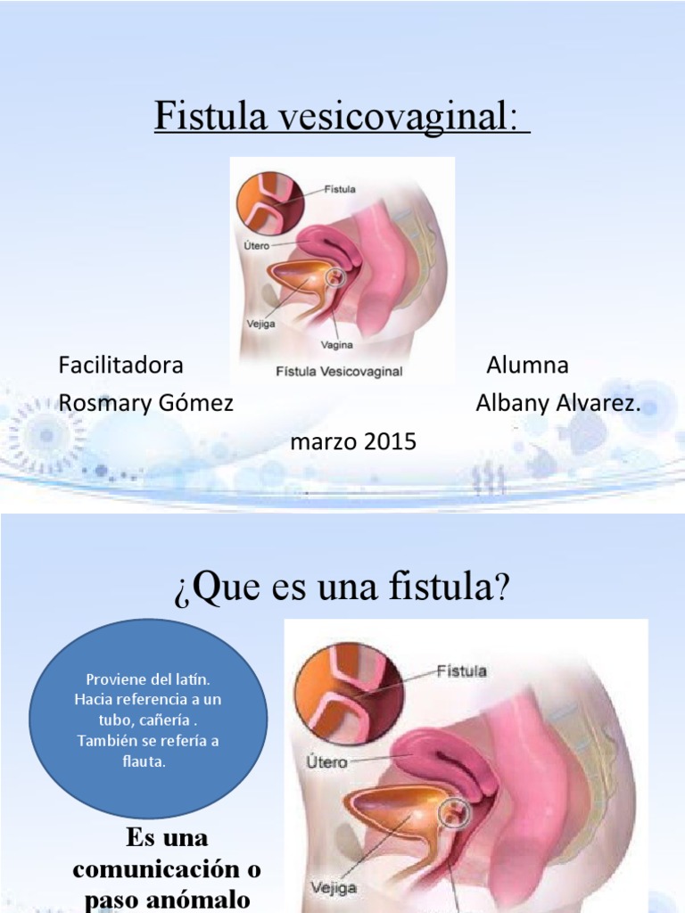Fistula | PDF | Vagina | Especialidades Medicas Fistula | PDF | Vagina | Especialidades Medicas