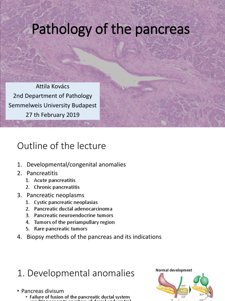 Pathology of the Pancreas Guide | PDF | Pancreas | Pancreatic Cancer
