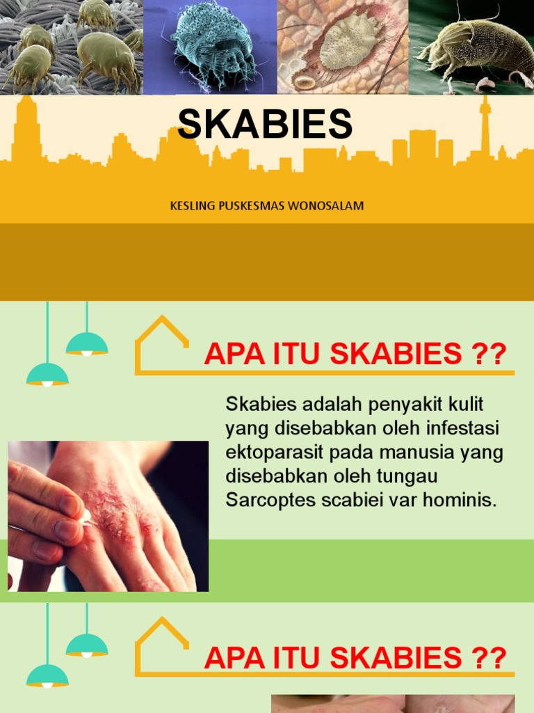 Scabies 2022 | PDF