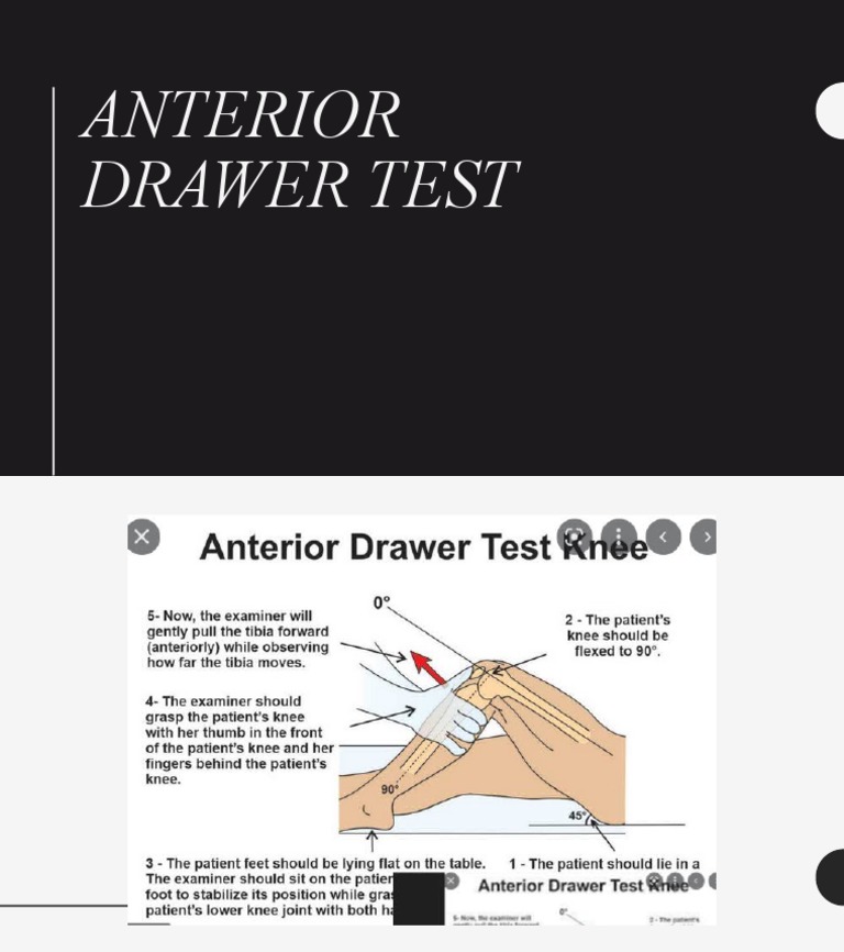 Anterior Drawer Test