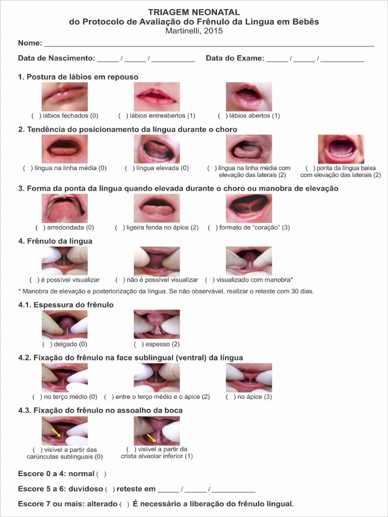 Triagem Neonatal MARTINELLI 2016 (1) | PDF