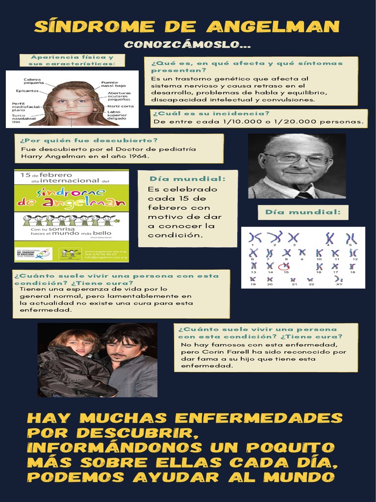 Síndrome De Angelman Pdf 2021 _ Síndrome de Angelman: MedlinePlus ...