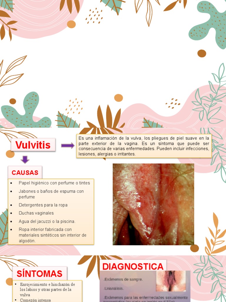 Infecciones de La Vulva | PDF | Vagina | Candidiasis