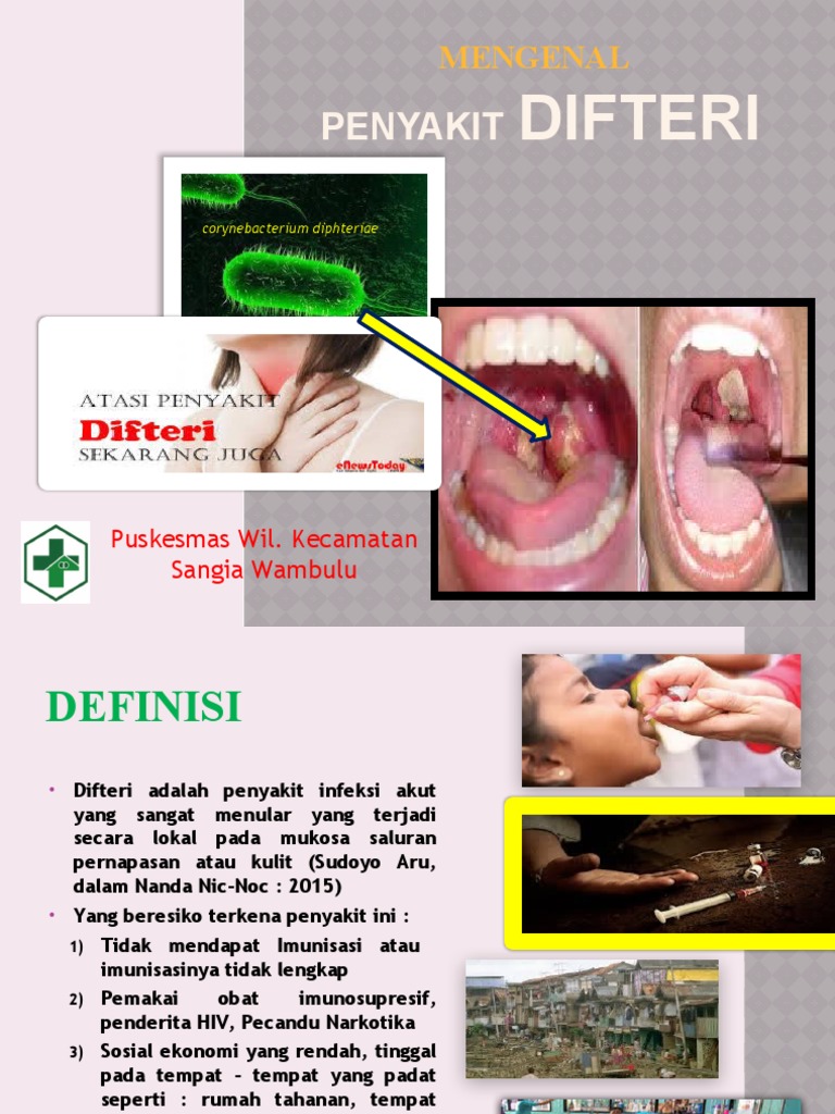 Power Point DIFTERI | PDF