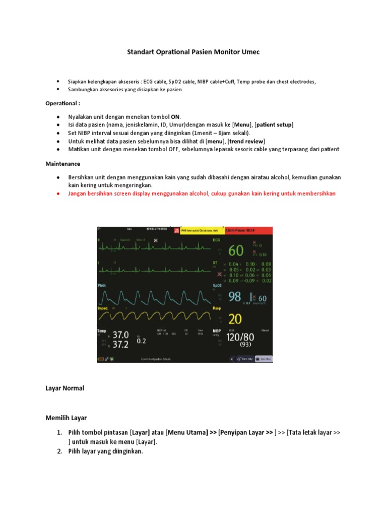 Sop Monitor Umec | PDF