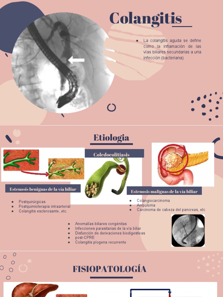 Colangitis | PDF | Órgano (anatomía) | Especialidades Medicas