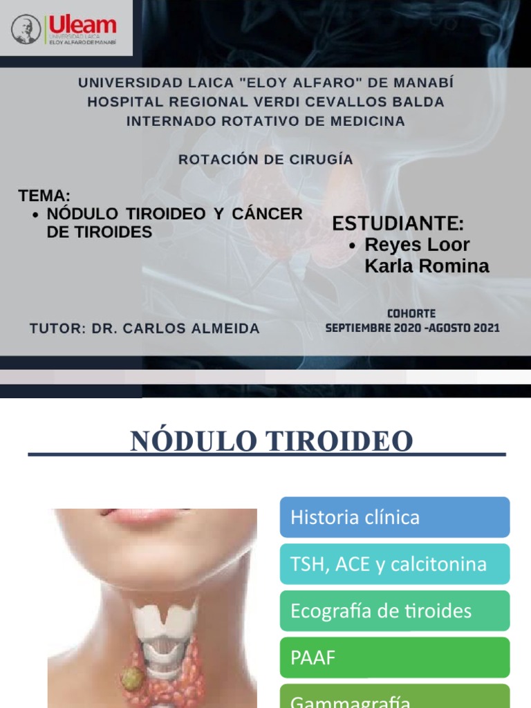 Diagnóstico y Tratamiento del Nódulo Tiroideo | PDF | Salud y bienestar ...