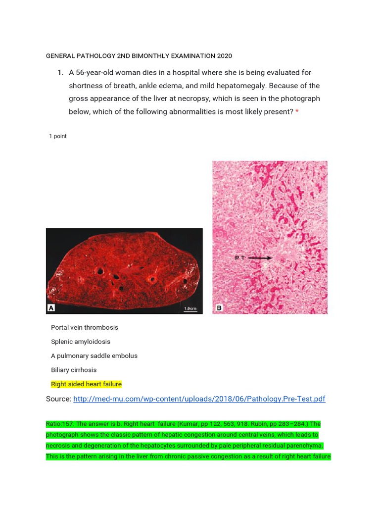 General Pathology 2nd BM Neoplasia Blood Vessel Cardiovascular ...