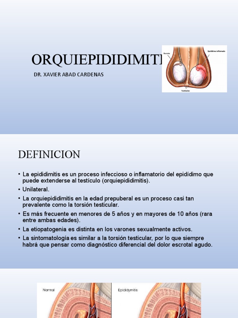 Orquiepididimitis y TB | PDF | Antígeno específico de la próstata ...
