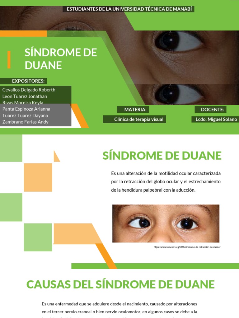 Sindrome de Duane | PDF | Ojo | Visión