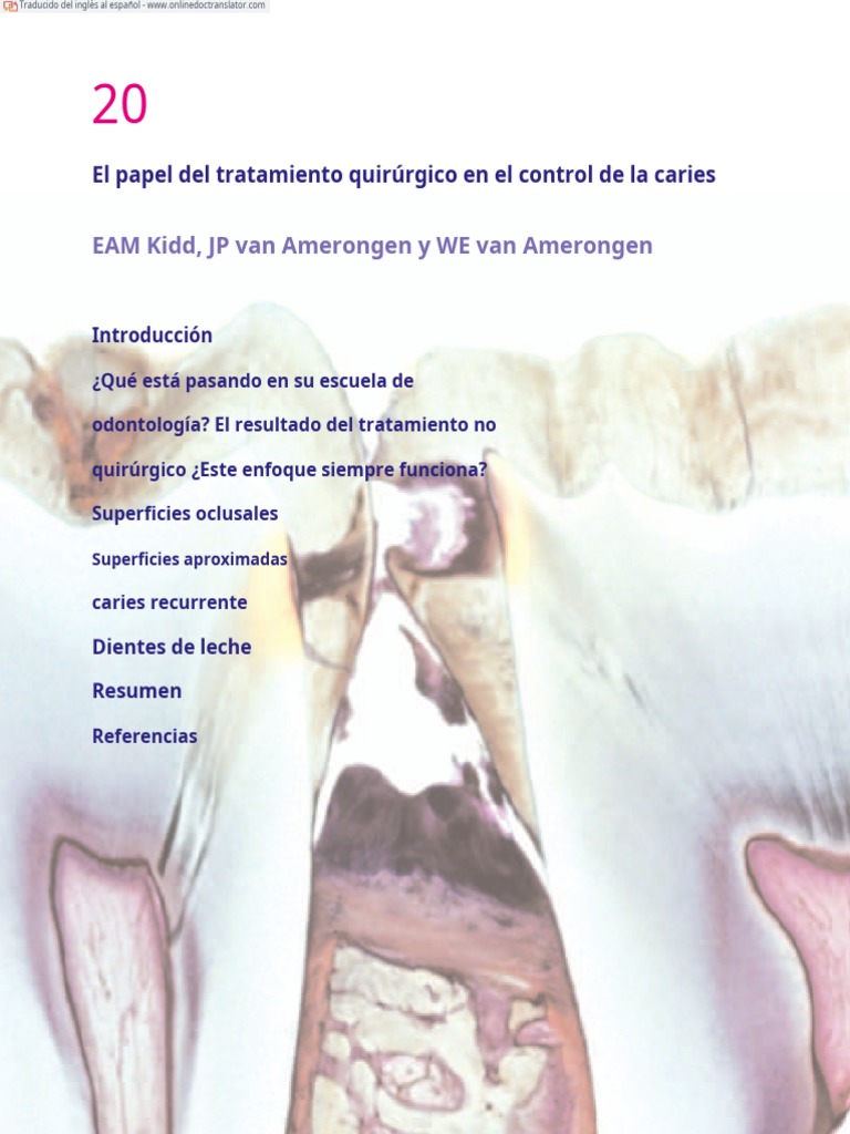 Dental Caries ... The Disease and Its Clinical Management - Fejerskov ...
