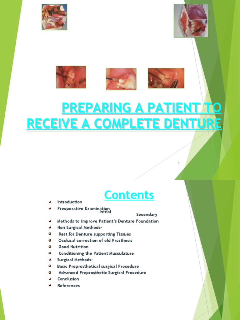 Mouth Preparation for Complete Dentures | PDF | Medical Specialties
