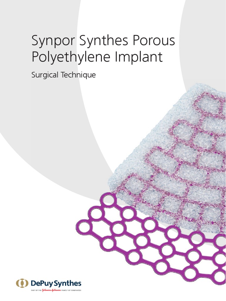 Synpor Synthes Porous Polyethylene Implant: Surgical Technique | PDF ...