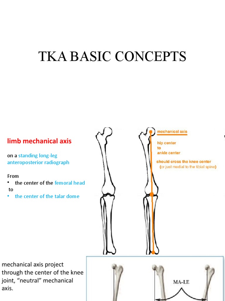 TKA Total Knee ARTHROPLASTY Replacement Conf 2 | PDF | Knee | Human Anatomy