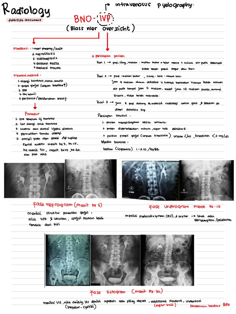 Catatan Radiologi BNO IVP Dan XFoto Thorax | PDF