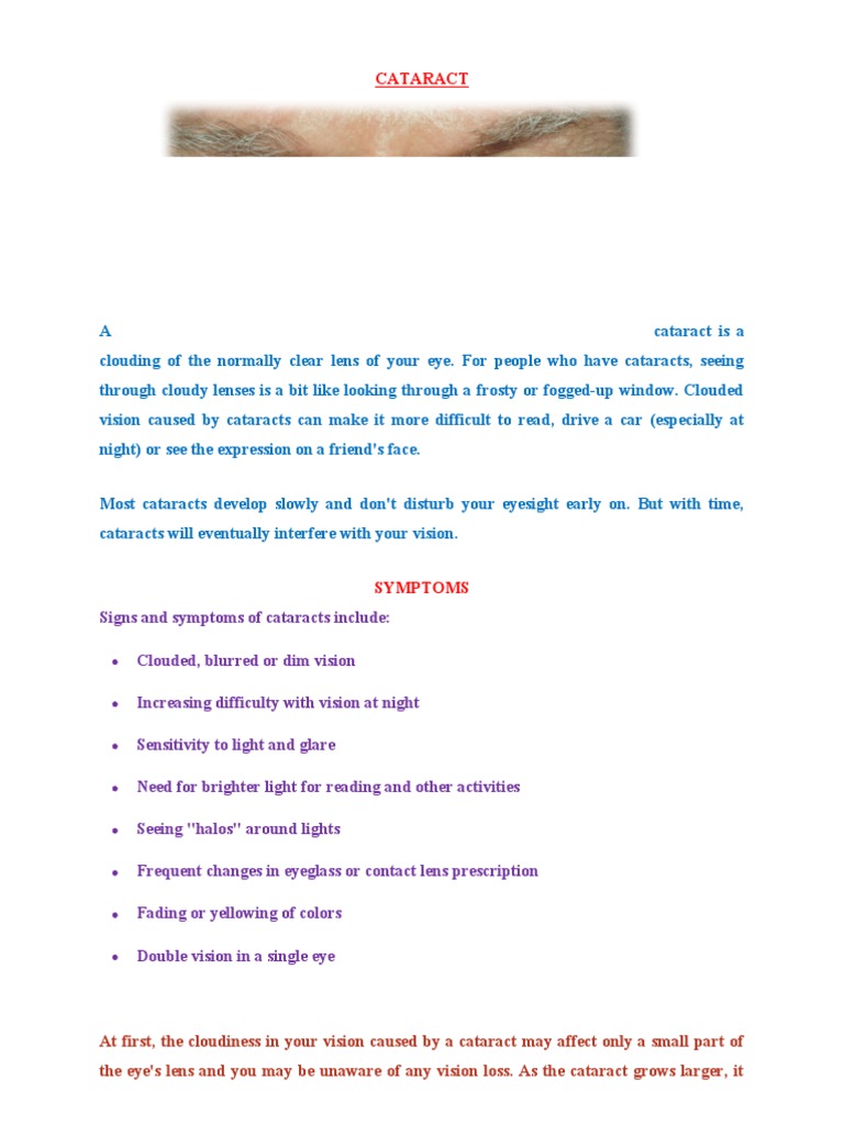 CATARACT | PDF | Eye | Clinical Medicine