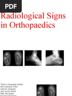 Winking Owl and Bamboo Spine Signs | PDF | Vertebral Column | Spinal Cord