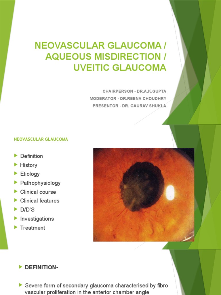 Neo Vascular Glaucoma (NVG) PPT GAURAV | PDF | Glaucoma | Medicine