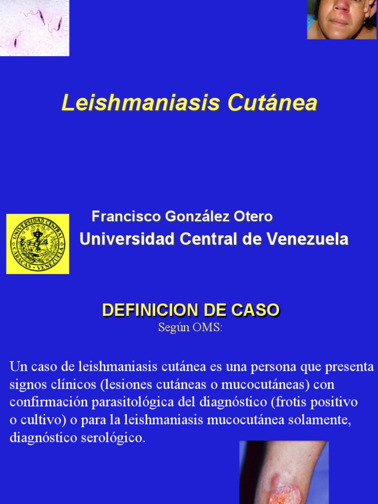 Leishmaniasis Cutánea | Inmunología | Medicina