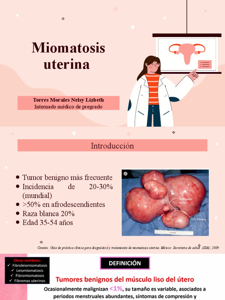 Miomatosis Uterina | PDF | Enfermedades y trastornos | Especialidades ...