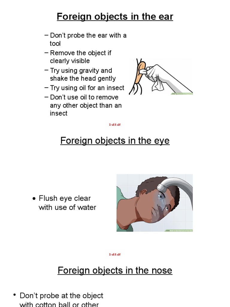 Foreign Objects in The Ear | PDF | Burn | Hypothermia