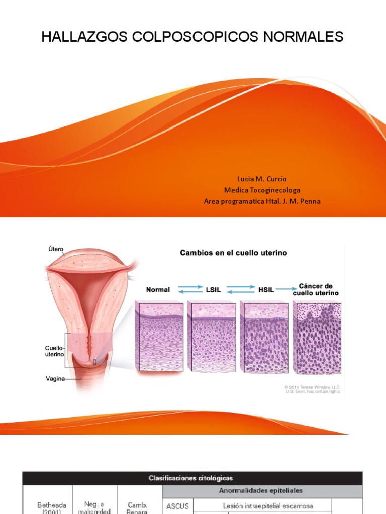 Colposcopia Normal | Descargar gratis PDF | Epitelio | Membrana mucosa