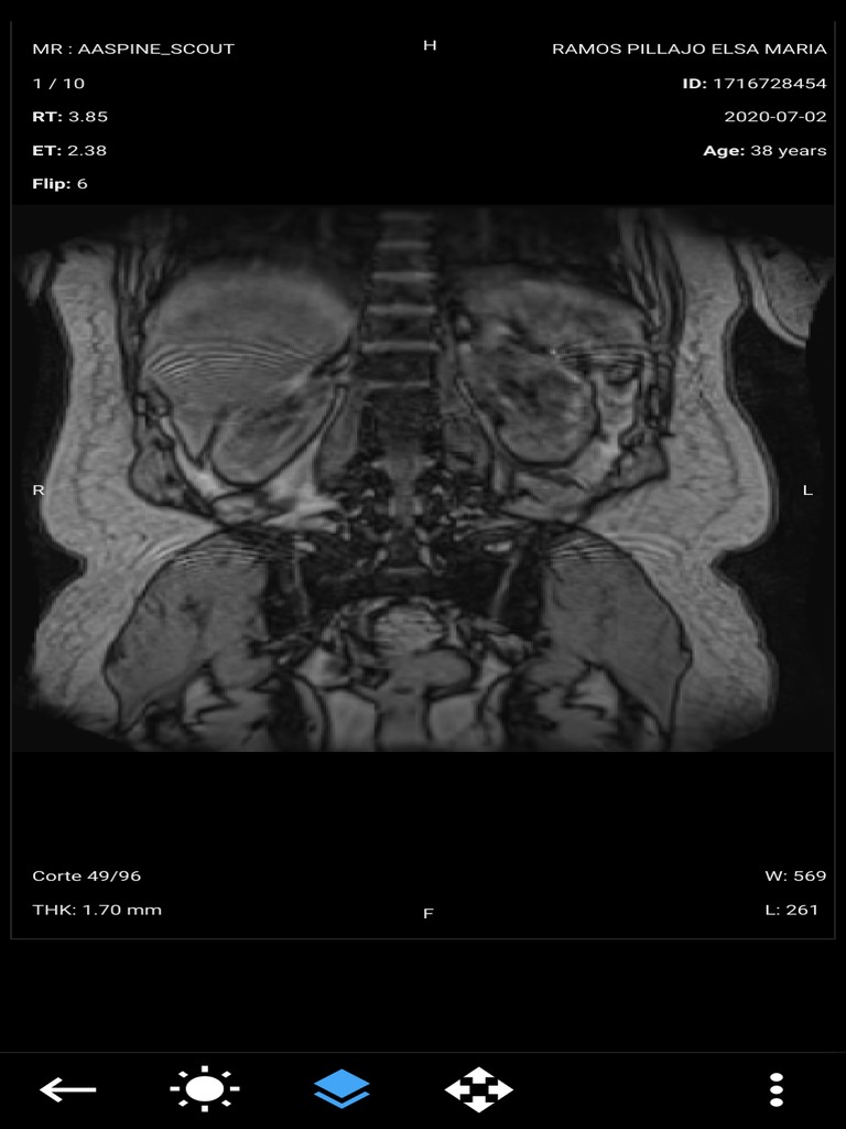 RX de Coxis | PDF