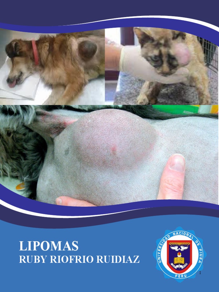 Lipomas | PDF | Neoplasias | Cáncer