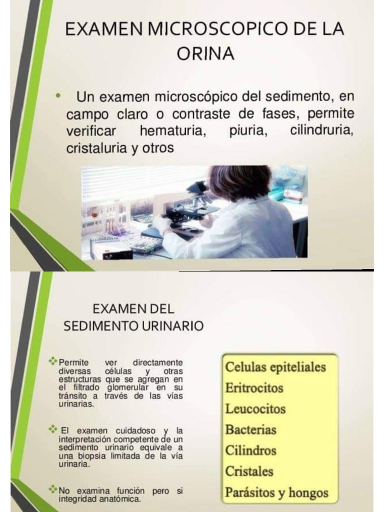 Exámen Microscópico de Orina PDF 20220621 14.33.00 | PDF