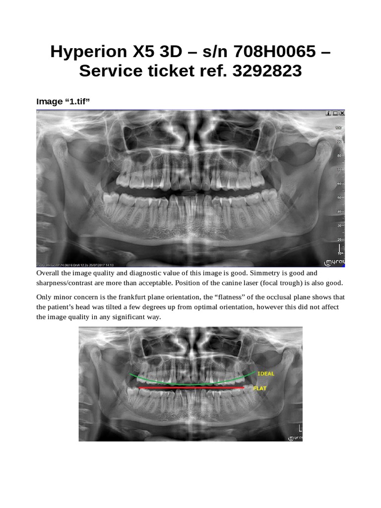 PAN - Analysis and Advice | PDF