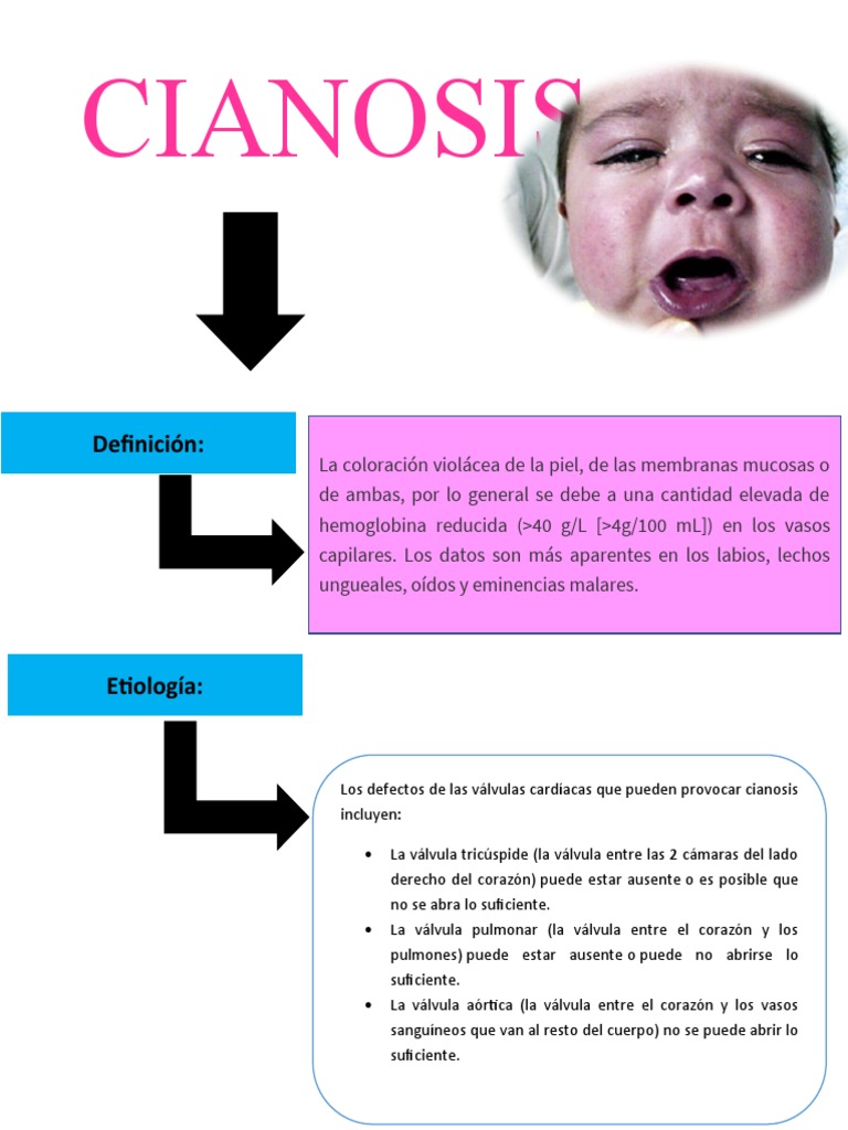 Cianosis | PDF | Medicina CLINICA | Especialidades Medicas