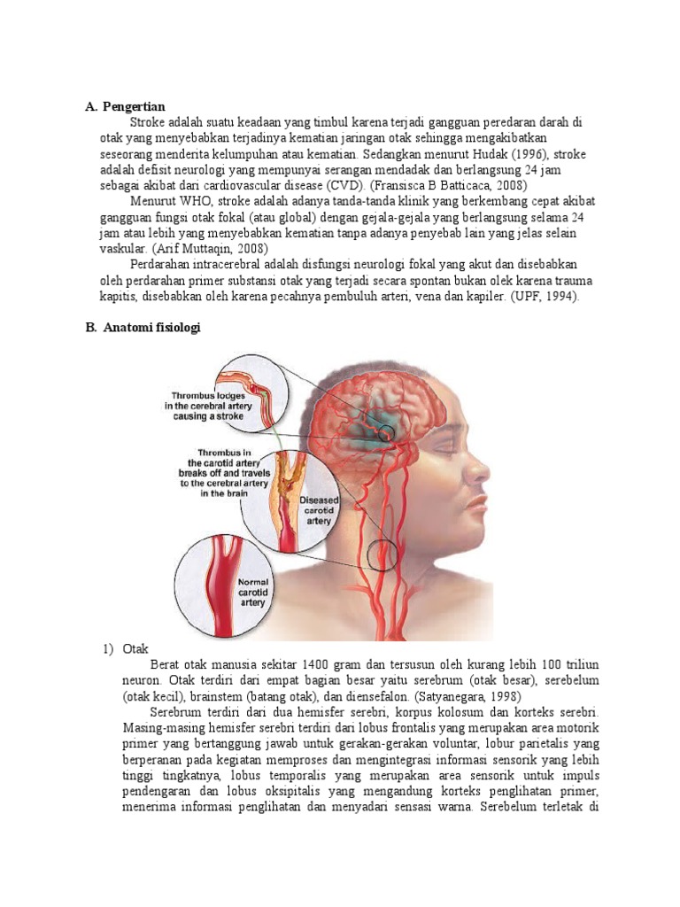 Konsep Stroke | PDF