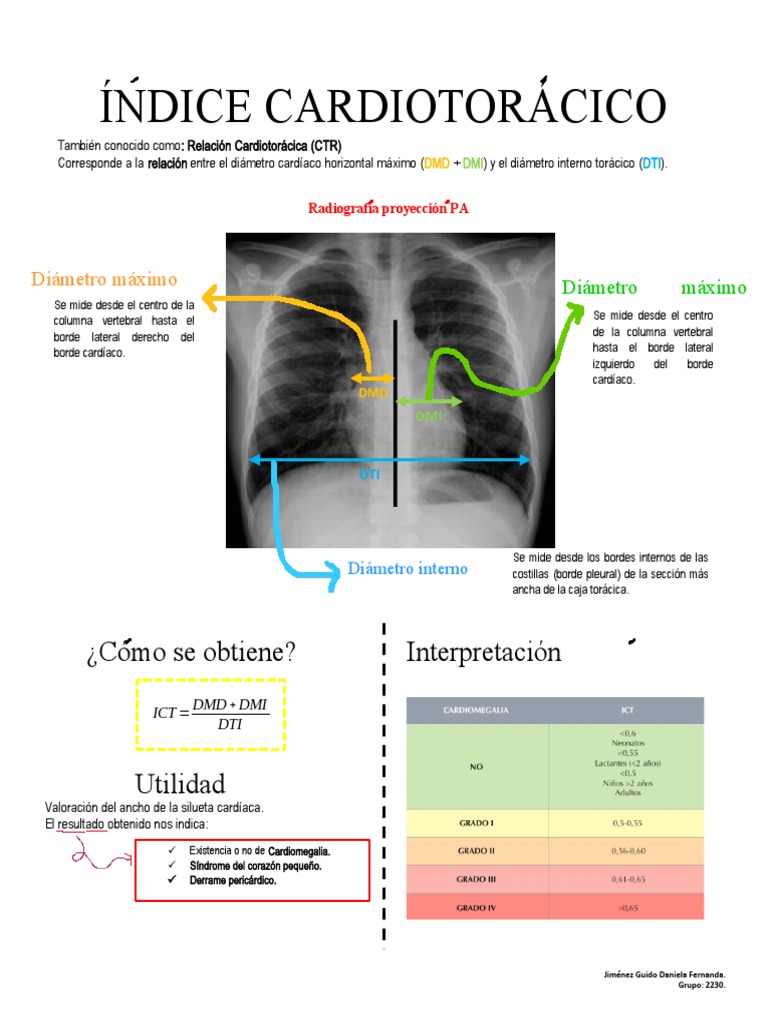 Índice Cardiotorácico. | PDF | Corazón | Medicina Interna